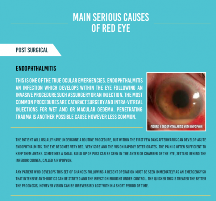 Acute Eye Condition Triage Booklet – Coming Soon! – OPTOMETRY EVOLUTION